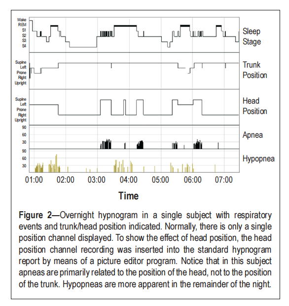 Quantitative Effects of Trunk and Head Position on the Apnea Hypopnea ...