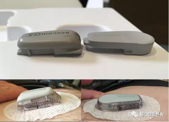 Dexcom G6 德康G6评测（CGM 蓝牙实时动态血糖监测） - 知乎