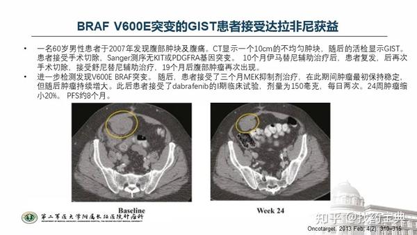 同肿瘤同基因，治疗方案大不同？第20轮长征MTB深入解密BRAF变异的消化道肿瘤 - 知乎