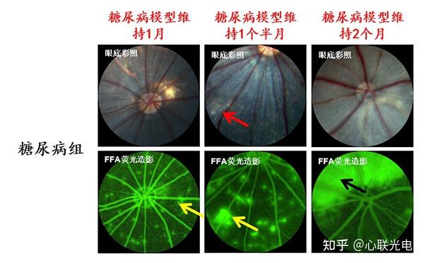 基于视网膜成像系统观察ZDF大鼠糖尿病视网膜病变模型眼底变化的技术服务 - 知乎