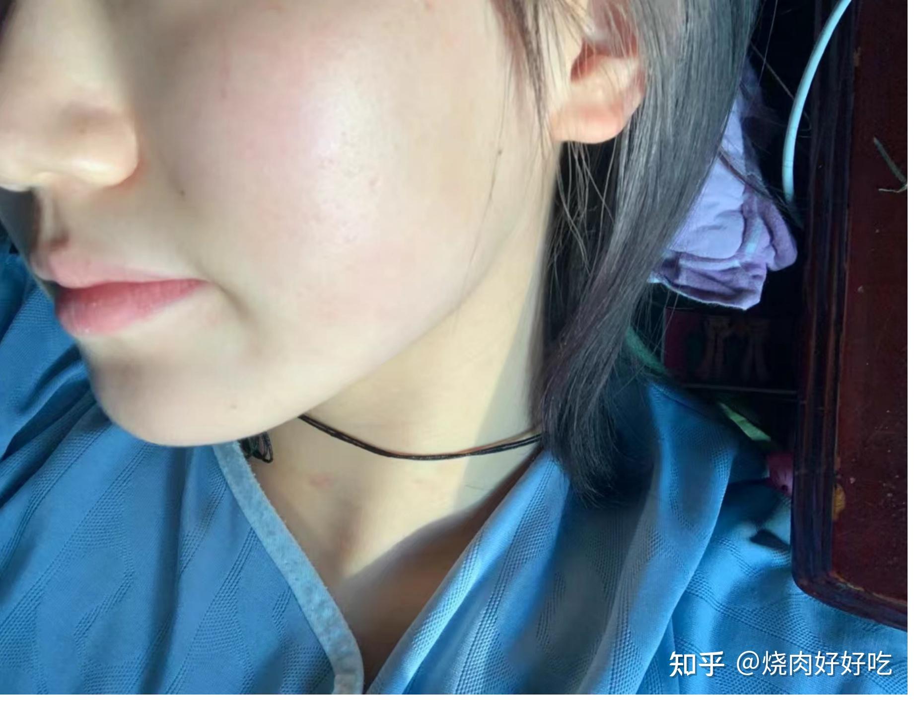 有什么真正能改善皮肤蜡黄,美白的产品吗? 知乎