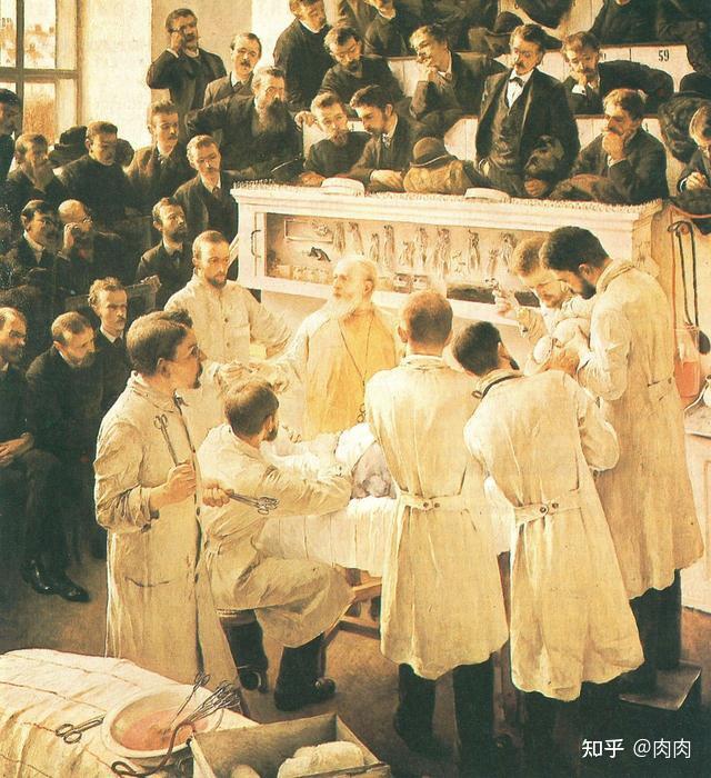 亿点点医学史：腹部外科学之父——Theodor Billroth - 知乎