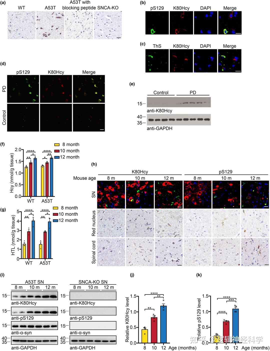 Aging Cell︱武汉大学人民医院张振涛团队揭示同型半胱氨酸修饰α-突触核蛋白在帕金森病中的作用 - 知乎