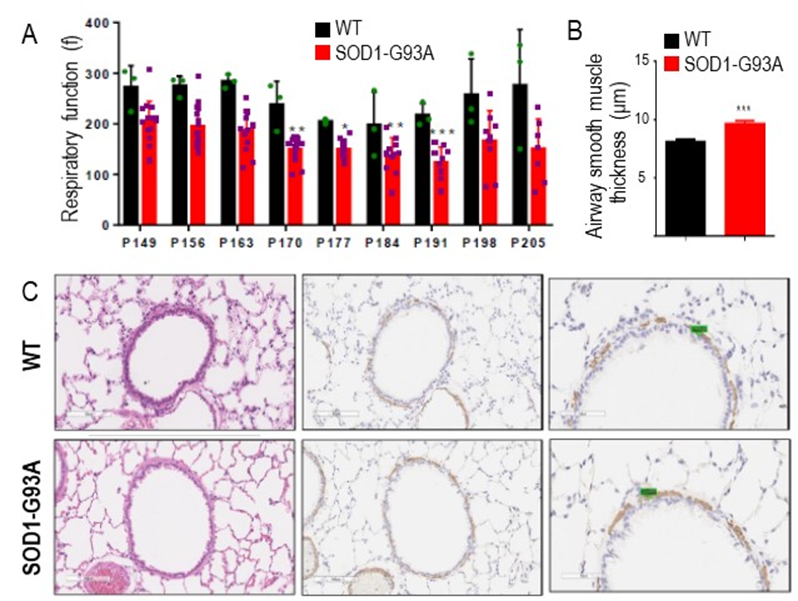 解码渐冻症 | 肌萎缩侧索硬化症发病机理及动物模型 - 知乎