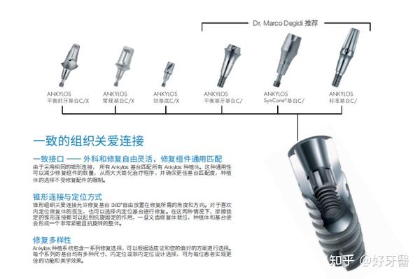 德国费亚丹FRIADENT Ankylos种植系统介绍 - 知乎