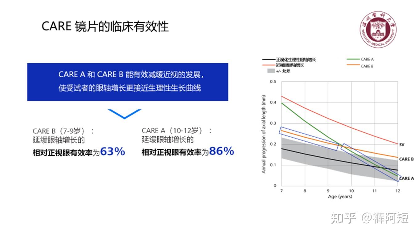 一文读懂蔡司小乐圆镜片,深度解析 知乎
