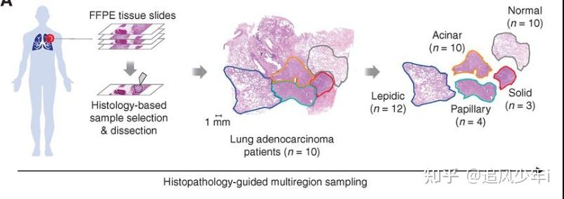 单细胞 & DSP(Digital Spatial Profiler)联合分析解析肺腺癌的转录重编程推动cancer evolution - 知乎