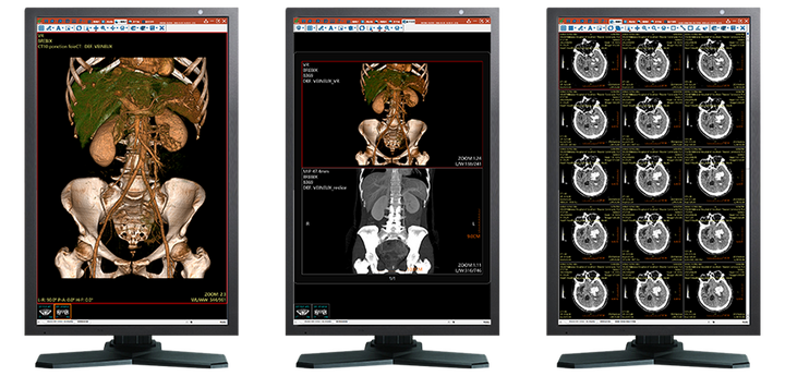 分享几个免费的国产医学影像浏览器 - 知乎