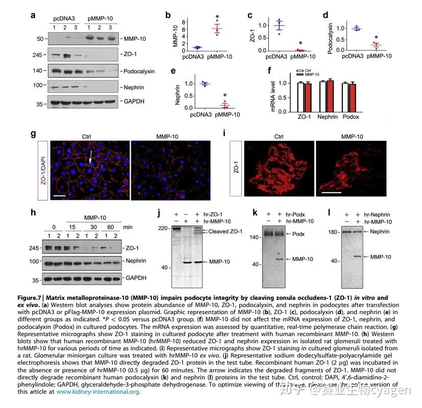 MMP10-新的足细胞损伤介导分子 - 知乎