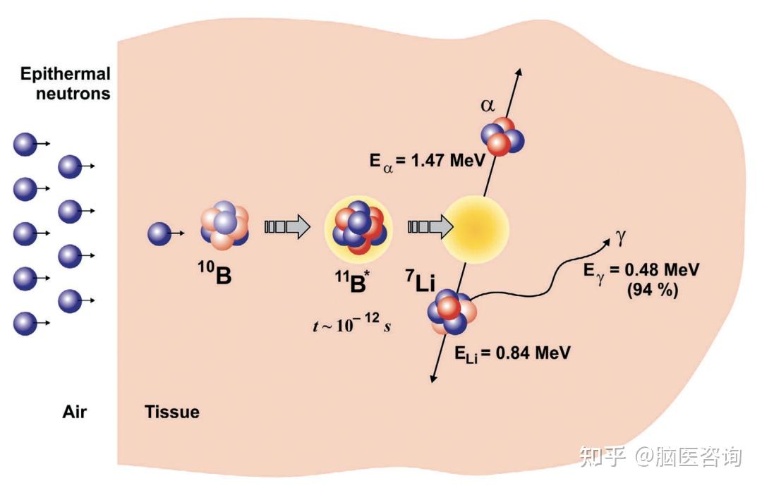 照射30分钟“爆破”癌细胞！黑科技硼中子俘获疗法到底有何神奇之处？ - 知乎