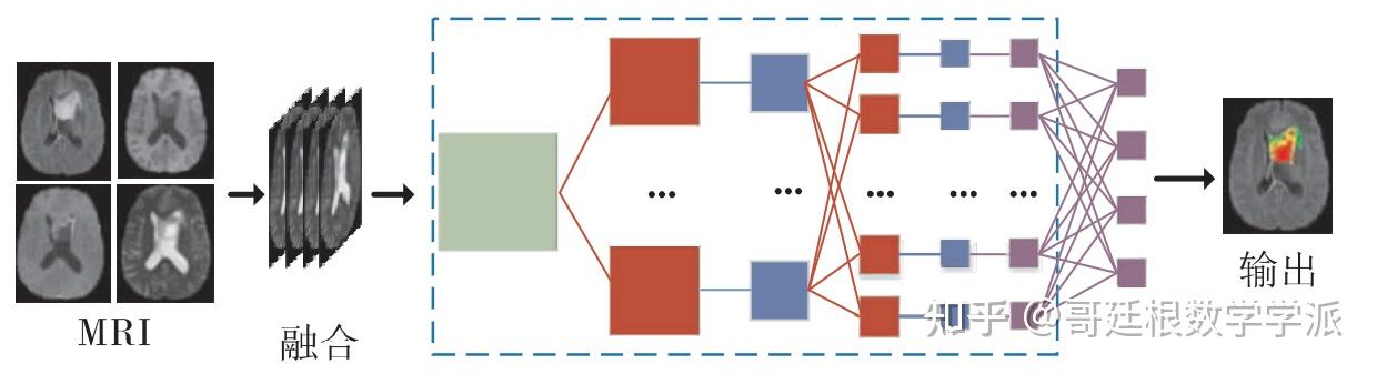 unet 模型有什么优势和特点？ - 知乎