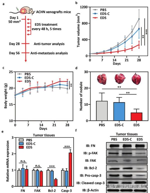 研究前沿｜逆转耐药 提高化疗敏感性！Adv. Mater：可转化的ECM剥夺系统有效抑制肾细胞癌 - 知乎