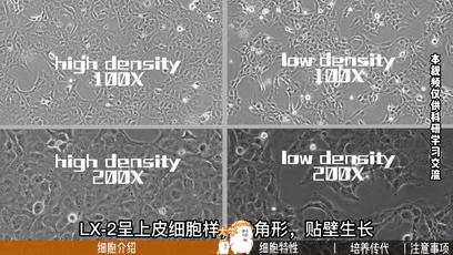 LX-2细胞培养，人肝星形细胞培养攻略 - 知乎