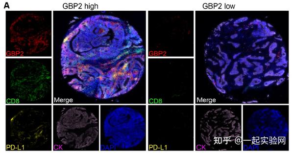 单基因生信文章的一区之路 - 知乎