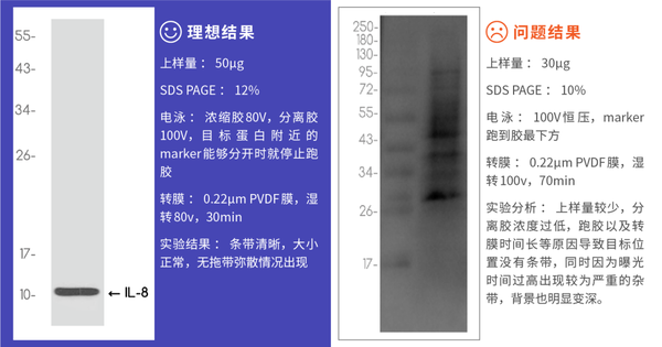 特殊蛋白WB实验技巧详解 - 知乎