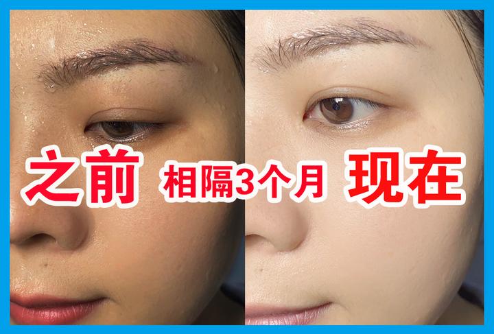全身美白的方法，皮肤美白最快的方法，吃什么美白丸精华产品食物哪个牌子好？吃什么水果可以美白用什么效果好？ 知乎