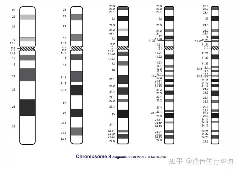 什么是染色体8q缺失综合症？ - 知乎