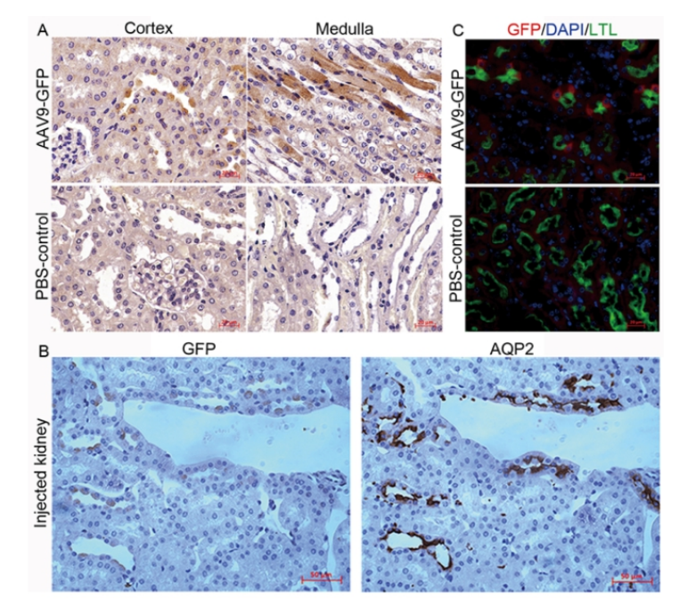 肾脏研究中常用的AAV注射方式有哪几种？ - 知乎