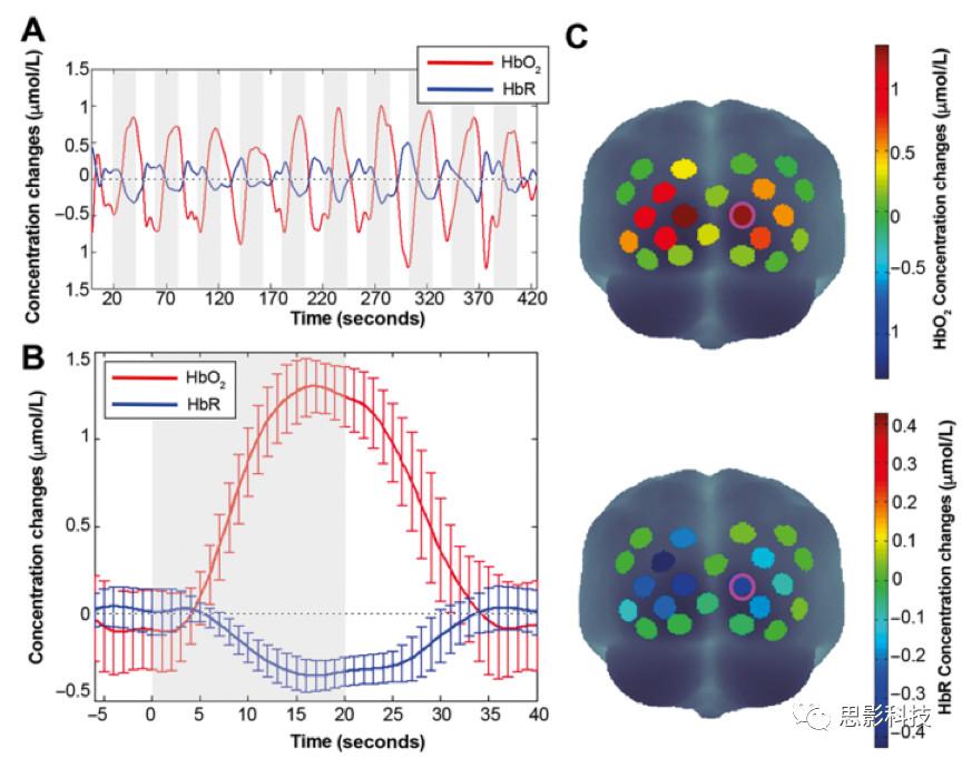 fNIRS在认知神经科学中的应用现状和未来 - 知乎