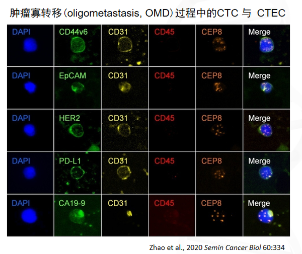 杰论系列 | CTC-iFISH检测在肿瘤体液活检中的临床意义与应用 - 知乎