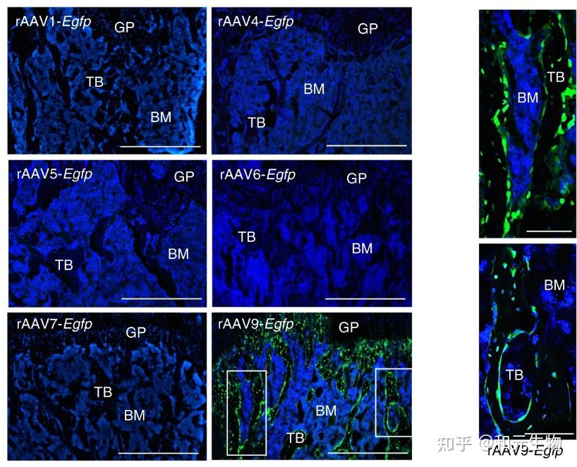 针对骨骼系统的AAV注射方式有哪些？ - 知乎
