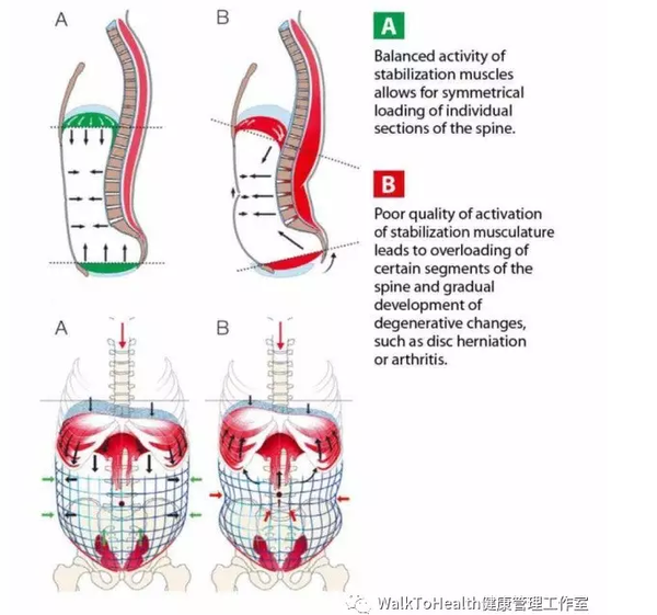 99%的腰痛人群都存在的问题——呼吸。 - 知乎
