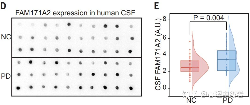 发现帕金森病病理蛋白扩散关键！复旦华山团队找到帕金森病原始创新靶点，并找到潜在治疗药物 - 知乎