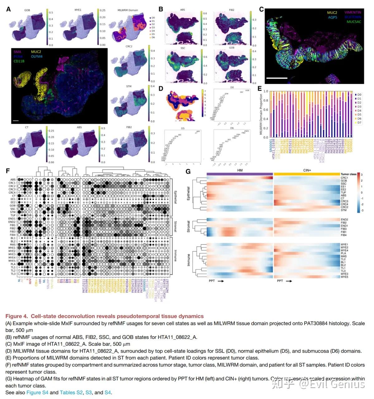 10X单细胞、空间、WES测序分析揭示肿瘤微环境进化区域异质性 - 知乎