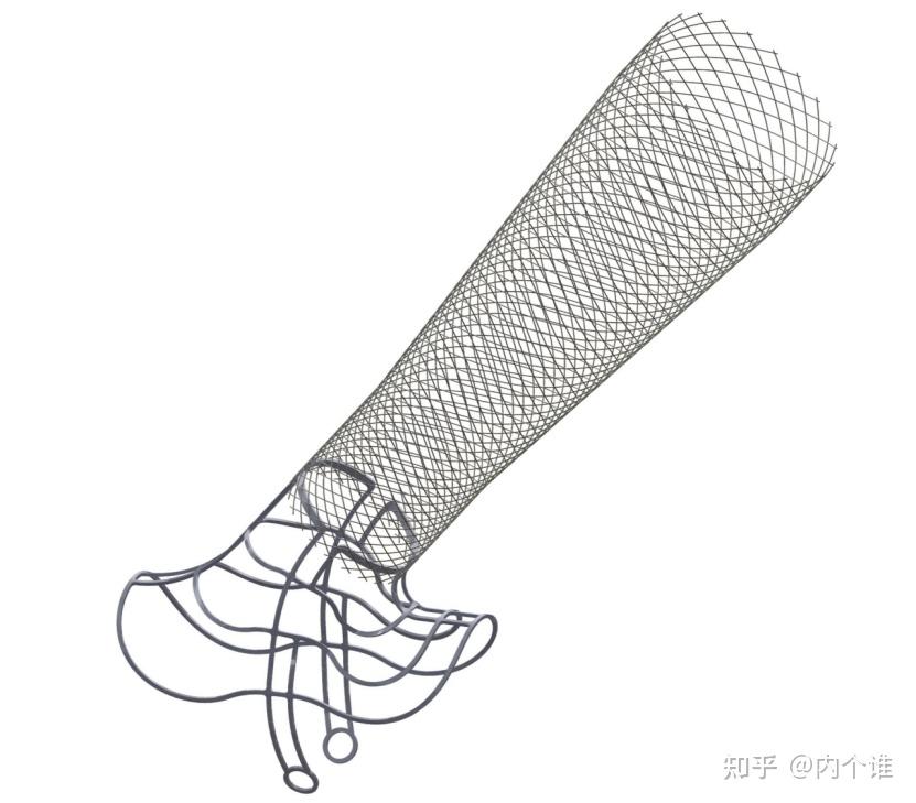 【行业资讯】VasQ血管外支架 - 知乎