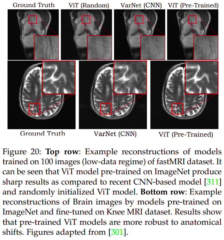【arXiv:2201】医学影像中的Transformers：一项调查 - 知乎