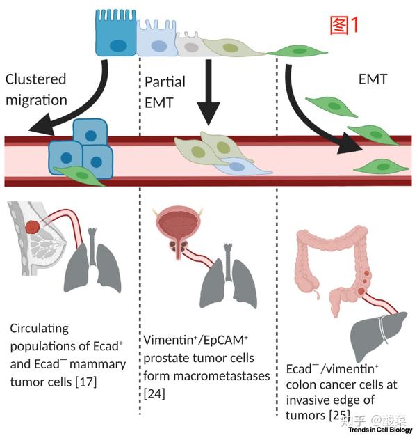 Cell子刊万字重磅综述阐述肿瘤的这2个特征 - 知乎