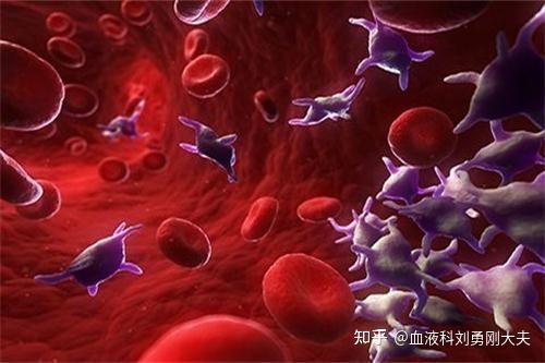 正确区分特发性血小板减少性紫癜与再障 知乎