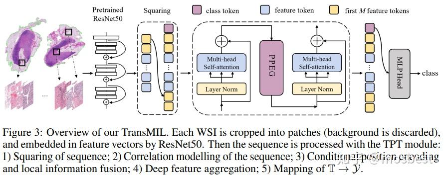 TransMIL: 基于 Correlated Multiple Instance Learning Transformer 用于 WSI ...