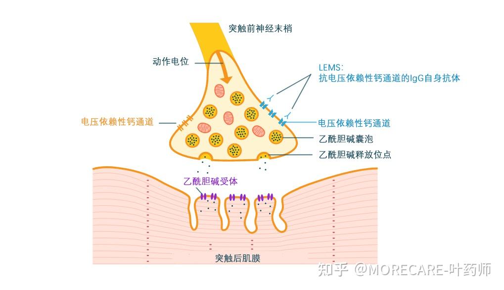 Lambert-Eaton肌无力综合征首个对症治疗药物：Firdapse(阿米吡啶) - 知乎