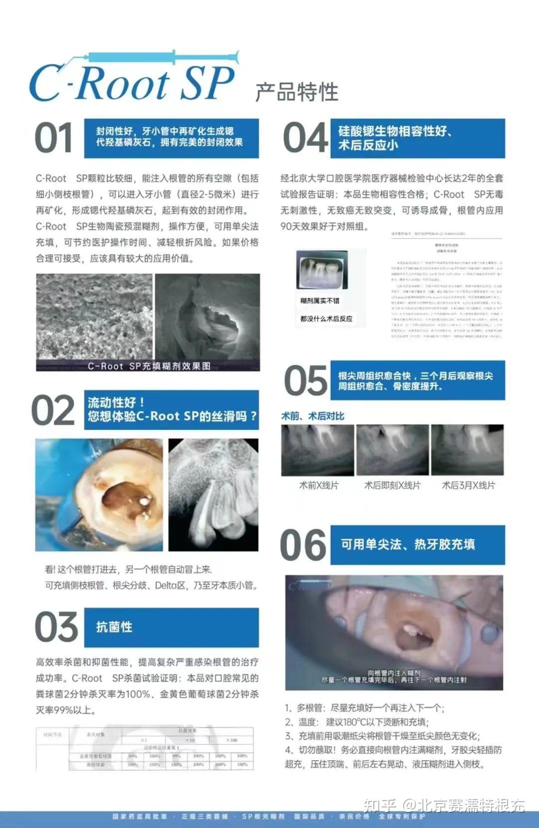 新一代根充材料 | 赛濡特C-Root SP助力患者，成就好牙医 ！ - 知乎