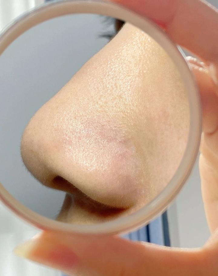 推荐几款好一点的去黑头产品？ 知乎