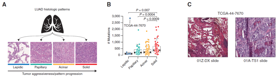文献解析 | DSP怎么用？详解GeoMx DSP 空间多组学在癌症研究中的应用 - 知乎