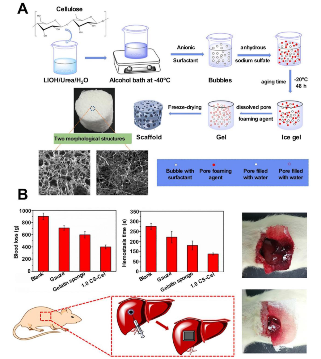 Theranostics︱吉林大学二院王旻/李建男团队综述：止血材料医学应用的最新研究进展 - 知乎