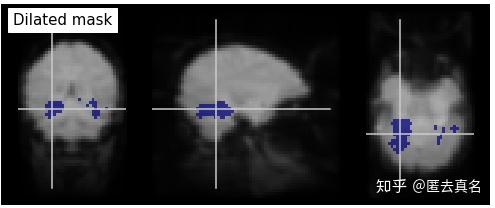 nilearn 笔记（16） - 知乎