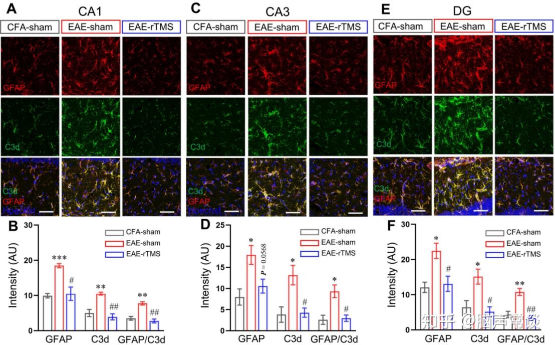 rTMS通过抑制海马中的神经毒性反应性星形胶质细胞来改善EAE小鼠的抑郁和焦虑 - 知乎