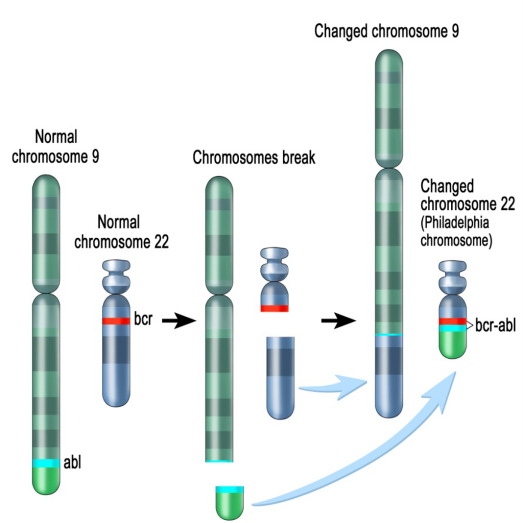 杰论系列 | 慢性髓性白血病诊疗过程中的分子学监测--BCR-ABL1融合基因与ABL激酶区突变的检测 - 知乎