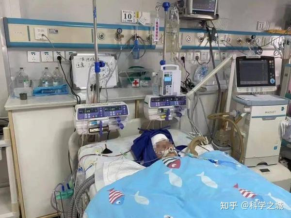 18天花掉113万，ICU到底是治病救人，还是“捞钱工具”？凭啥这么贵 - 知乎