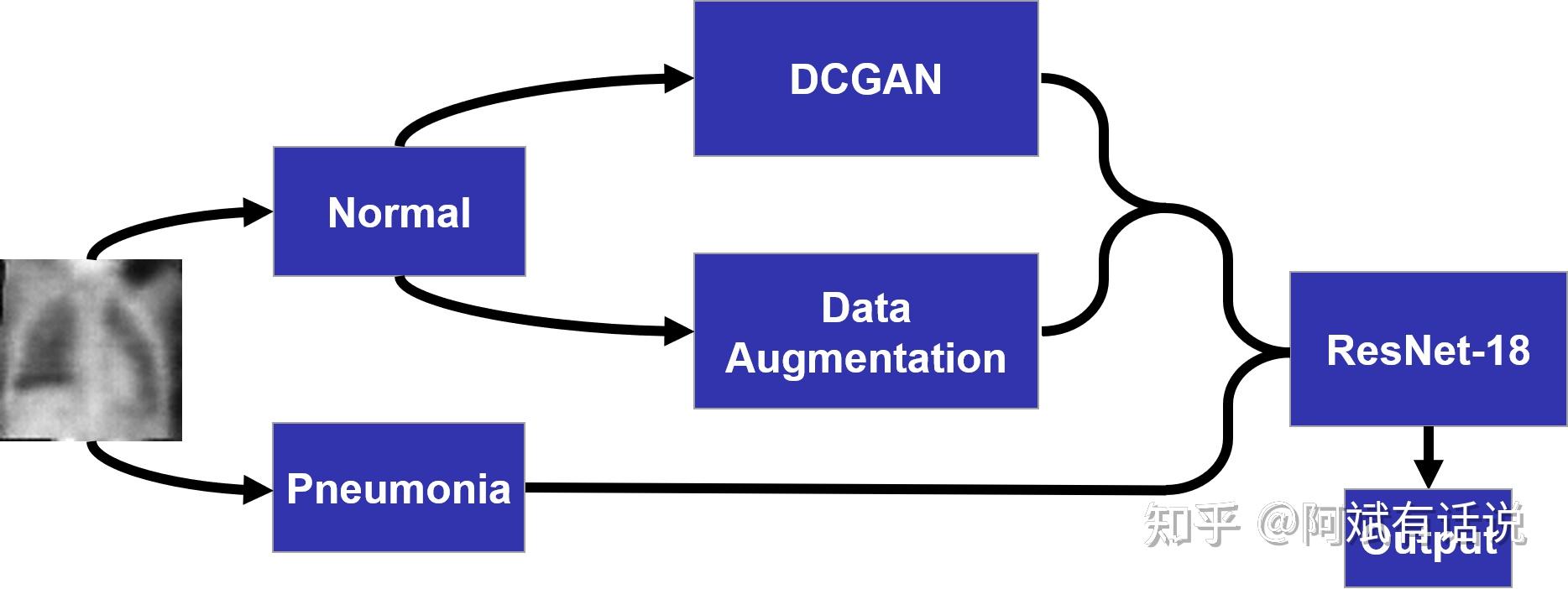 基于CNN与DCGAN的肺炎图像分类 - 知乎