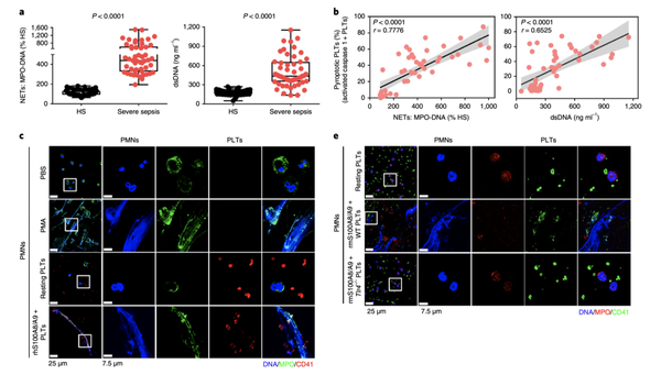 Nature最新大子刊丨脓毒症-血小板-GSDMD-NETs - 知乎