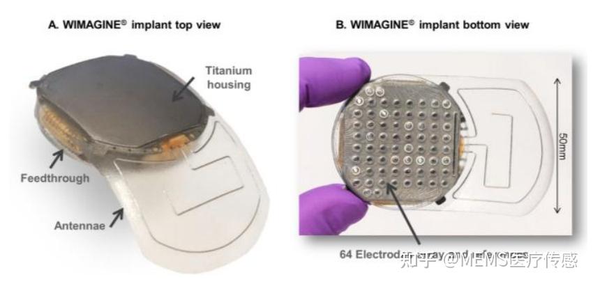 脑机接口之ECoG电极（一） - 知乎