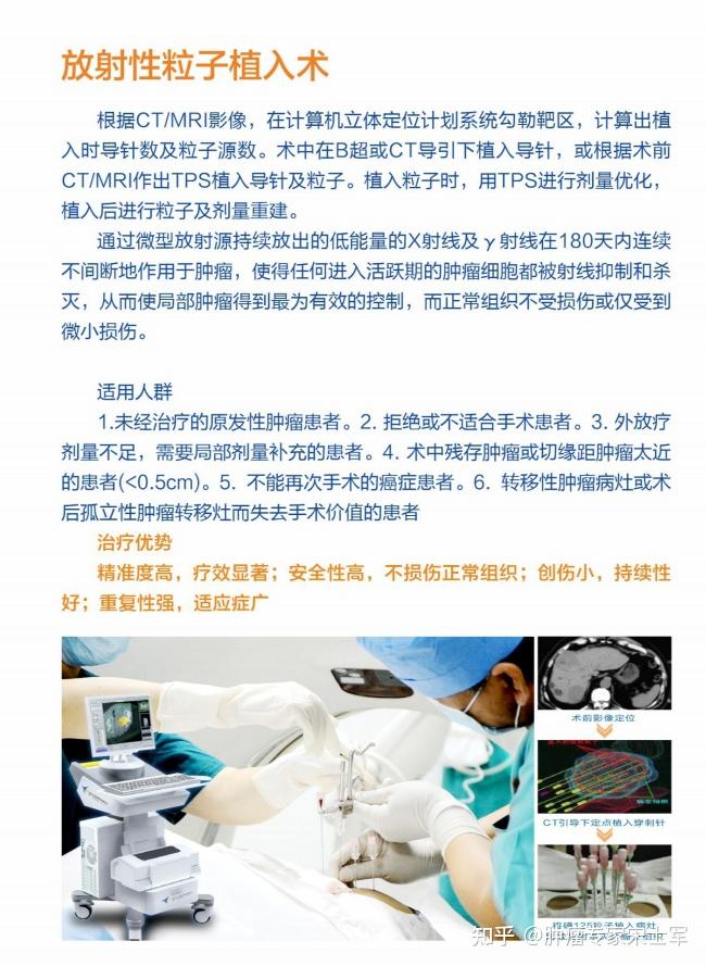 肿瘤微创治疗技术—放射性粒子植入术 知乎 5515