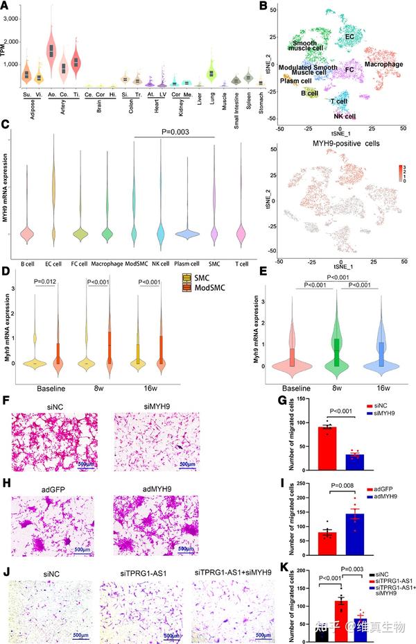 中国医学科学院阜外医院王来元/顾东风研究团队揭示LncRNA TPRG1-AS1在抑制动脉粥样硬化中的关键作用! - 知乎