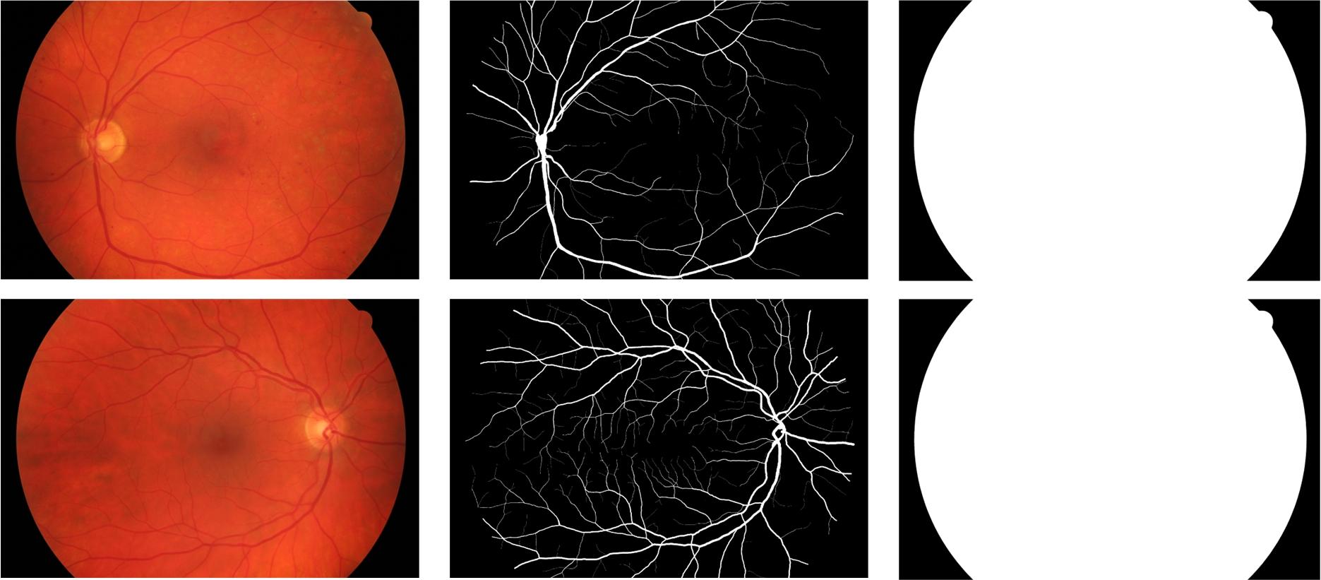 HRF 数据集介绍 - 知乎