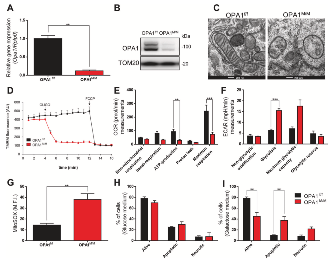 CDD丨OPA1 通过 p65 信号驱动巨噬细胞代谢和功能承诺 - 知乎