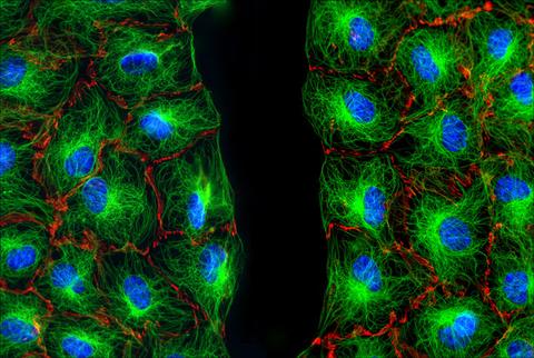 ImageJ实用教程汇总 - 知乎